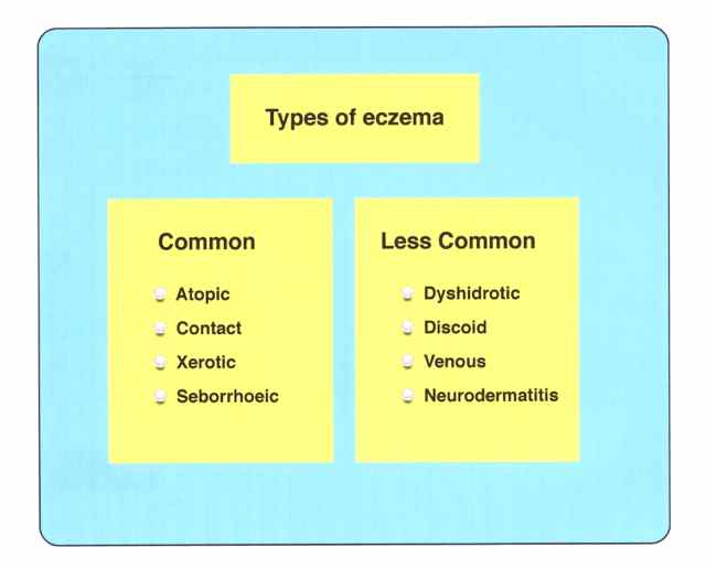 Friday Facts 25 The Main Types Of Eczema